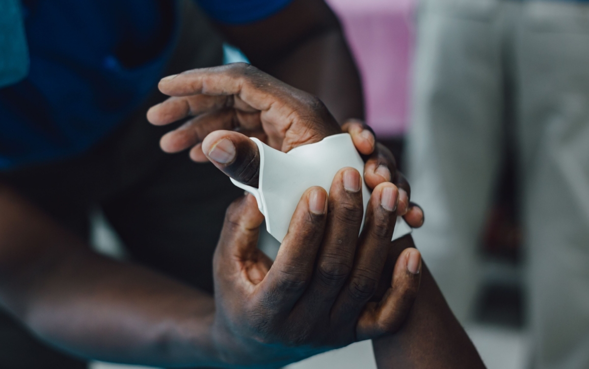 How Much Does the Road Accident Fund Pay for a Hand Injury? | PM Attorneys